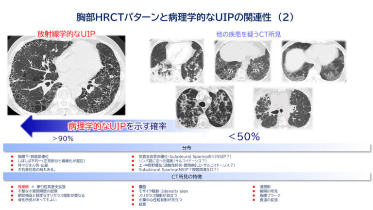 胸部HRCTで蜂巣肺・多発嚢胞・気腫を鑑別してみる | 呼吸器内科医のブログ LungDr Note