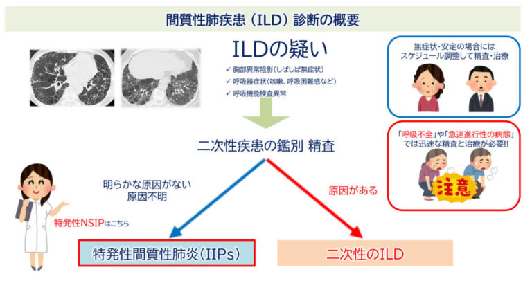 特発性NSIPとはどんなものか？ HRCTと病理について | 呼吸器内科医のブログ LungDr Note