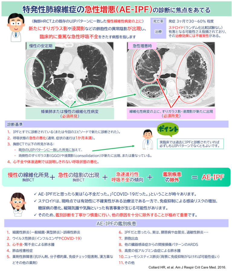 特発性肺線維症の急性増悪（AE-IPF）の診断に焦点をあてる | 呼吸器内科医のブログ LungDr Note
