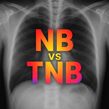 Navigational Bronchoscopy vs Transthoracic Needle Biopsy― 肺結節に対する診断手技、どっちがベター？ ― | 呼吸器内科医のブログ ...