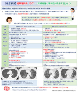 過敏性肺炎①～ざっくりと解説～ | 呼吸器内科医のブログ LungDr Note