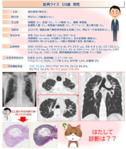 特発性Pleuroparenchymal Fibroelastosis（iPPFE）をやさしく解説①―疾患概念と臨床像について | 呼吸器内科 ...