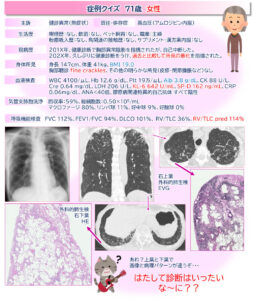 特発性Pleuroparenchymal Fibroelastosis（iPPFE）をやさしく解説②―画像と病理所見、下葉病変の意義 | 呼吸 ...