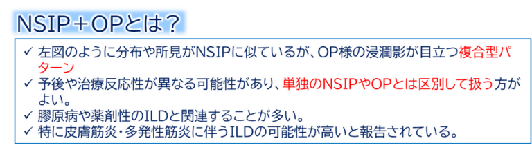 【新国際分類2025】その5 Nonspecific interstitial pneumonia（NSIP） | 呼吸器内科医のブログ LungDr Note