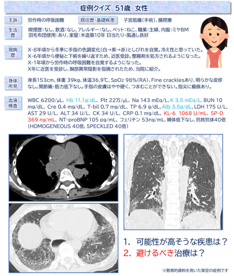 症例クイズ2 | 呼吸器内科医のブログ LungDr Note